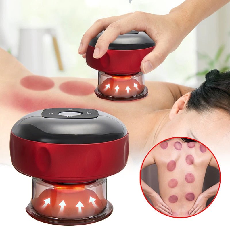 ProSuction Electric Cupping Set — Flamin' Fitness